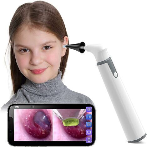 Caméra d'oreille d'otoscope sans fil avec double vue, portée d'oreille ...